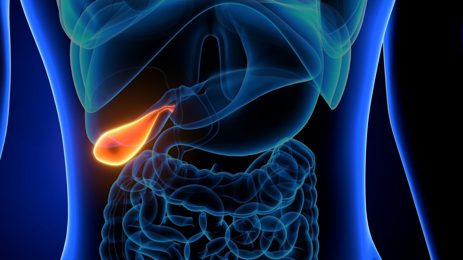 Gallstones | Cholelithiasis