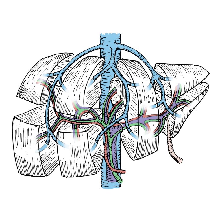 Liver Surgery Hepatectomy – Liver resection – Partial hepatectomy