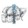 Liver Surgery Hepatectomy – Liver resection – Partial hepatectomy